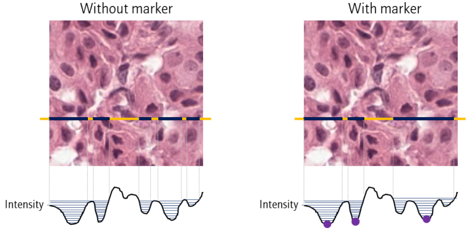 Medical Image Segmentation - Region growing / Watershed algorithm